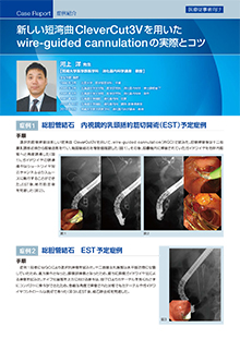 Case Report 新しい短湾曲CleverCut3Vを用いたwire-guided cannulationの実際とコツ|動画・レポート ...